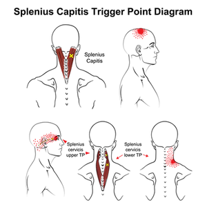 Neuromuscular Therapy/injury/postural realignment with Marilyn Edwards